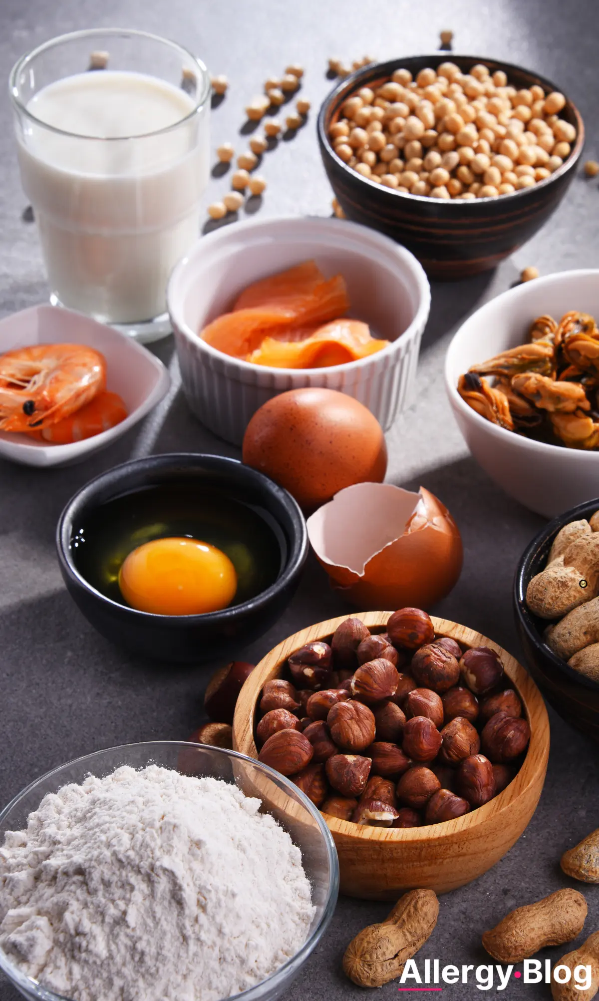 Food allergy: The basics